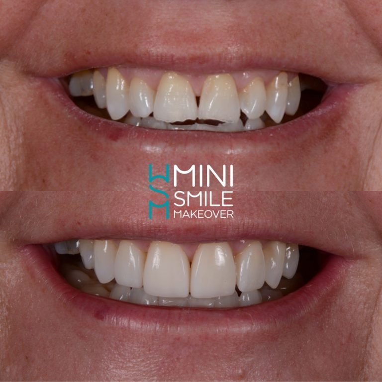 Smile assessment Billericay- Billericay Dental Care